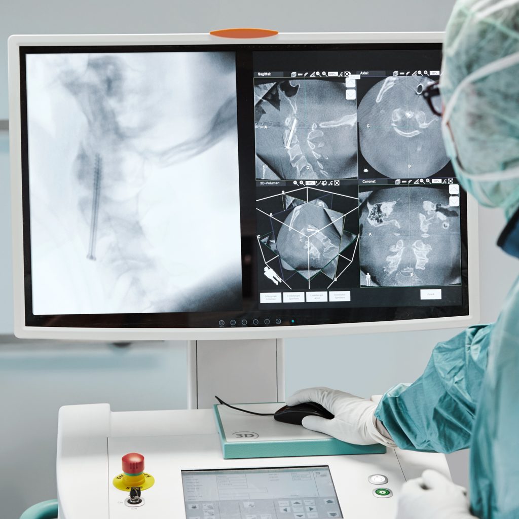 Ziehm Vision RFD 3D - Sharp Medical